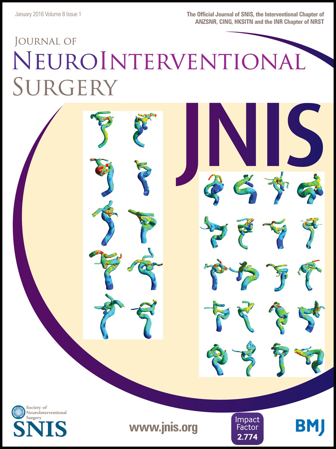 Cone-beam CT angiography (Dyna CT) for intraoperative localization of ...