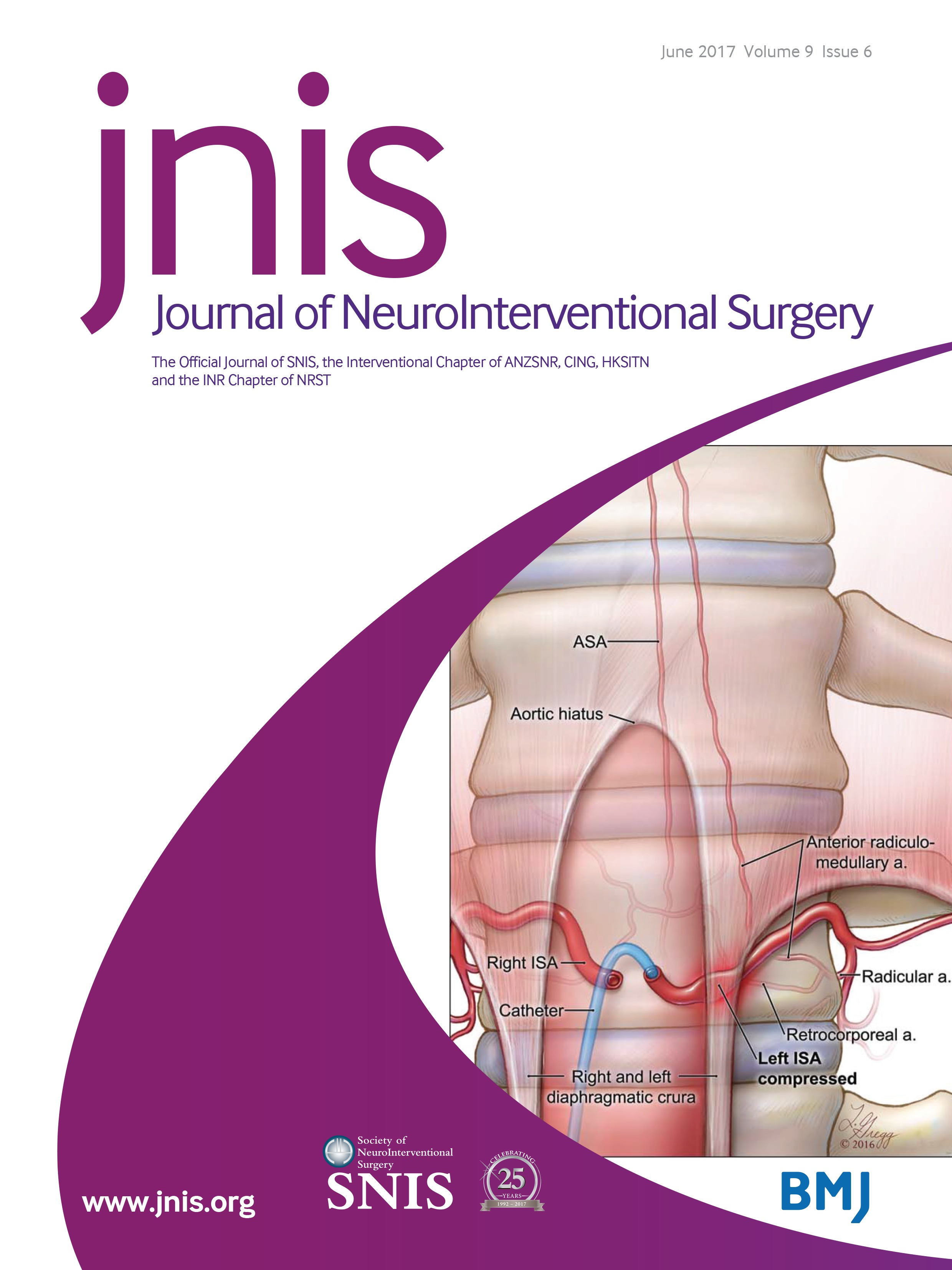 Intraoperative spinal digital subtraction angiography: indications ...